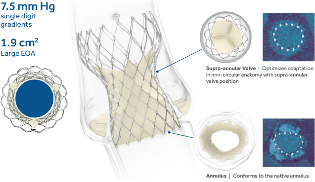 Medtronic: A Healthy, Painless Investment - Medtronic plc (NYSE:MDT ...